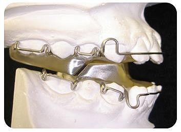 Dentistry and Medicine: Functional appliances-Orthodontic Lecture note