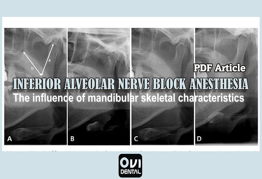 PDF: The influence of mandibular skeletal characteristics on inferior ...