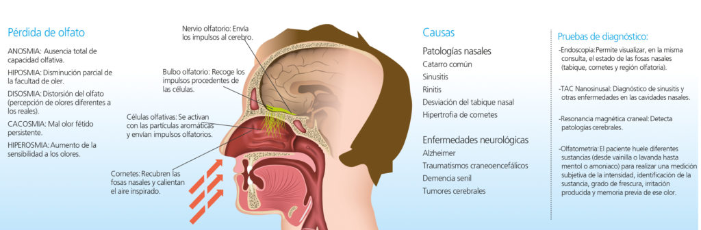 Anosmia Anosmia. Causes, symptoms, treatment Anosmia