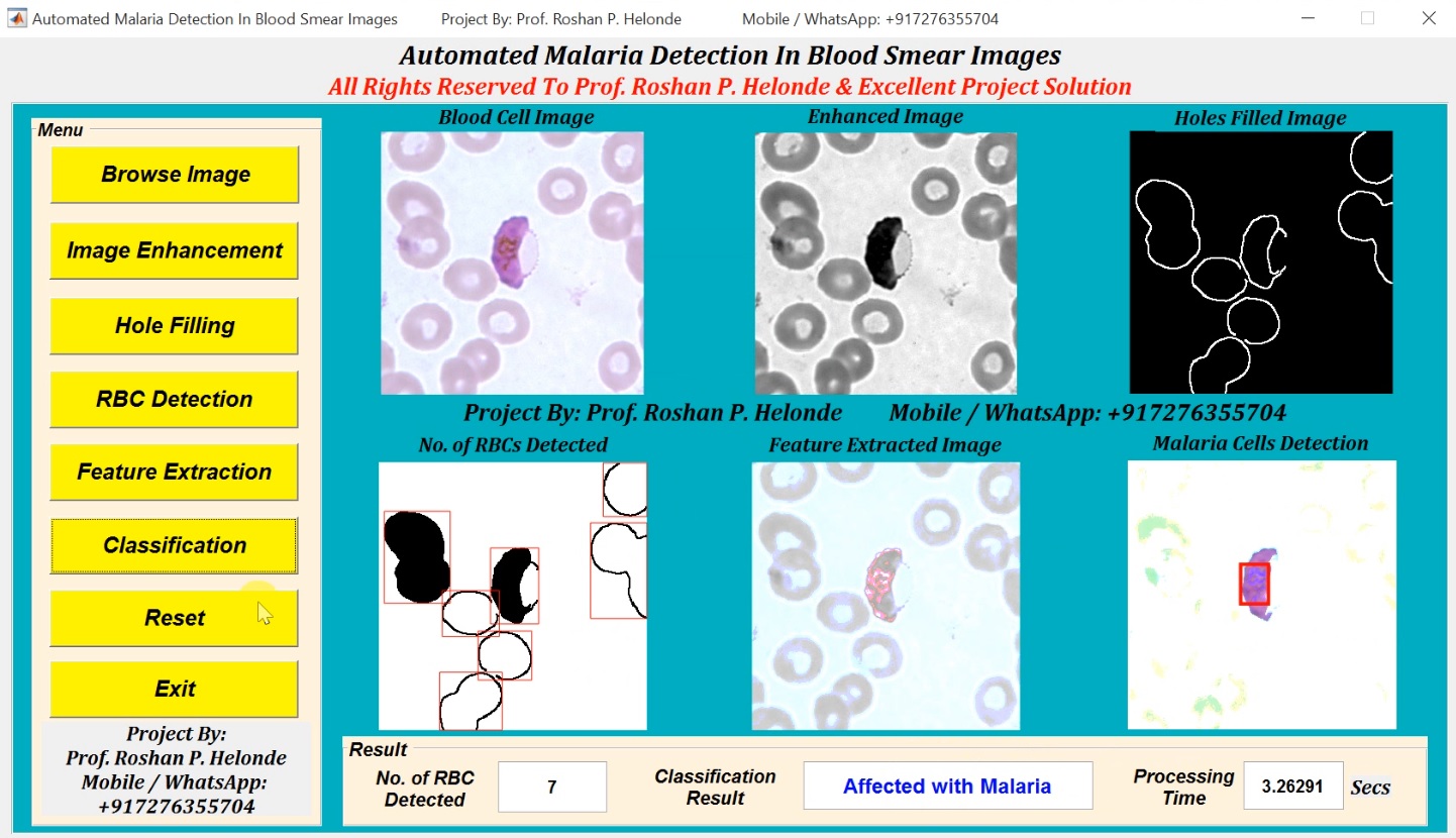 Automated Malaria Detection In Blood Smear Images Using Image Processing || IEEE Based Projects ...