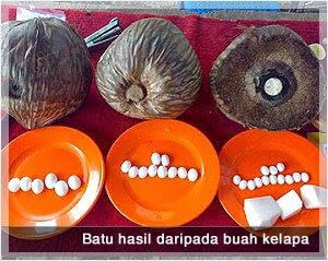 UnitedLuckyStone_Mystic Items Blog: Buntat Kelapa