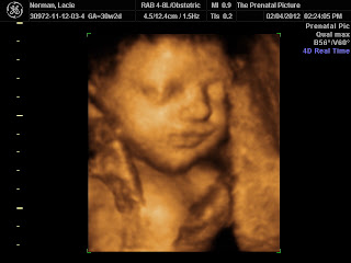 The Norman Family Blog....: 4D Ultrasound (30 Weeks & 2 Day)