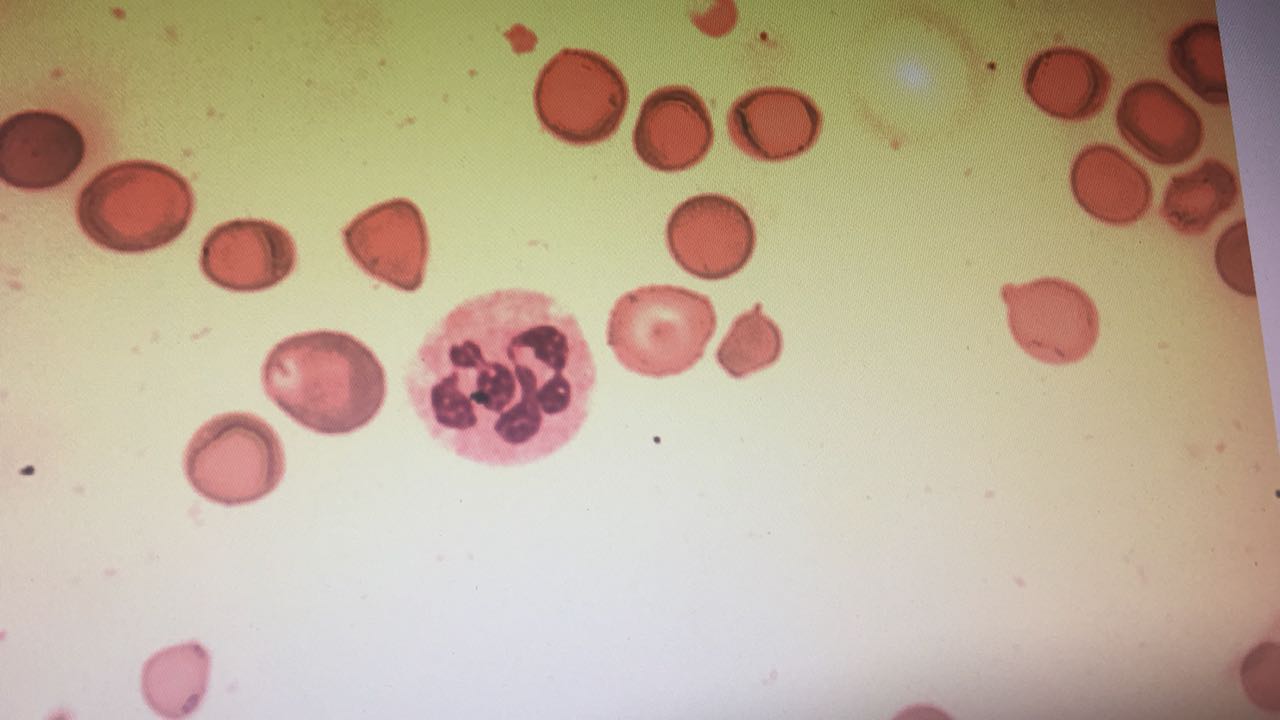 EL RINCÓN DE LA MEDICINA INTERNA. juanpedromacaluso@yahoo.com.ar: Mujer ...