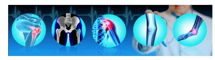 SOLUSI MASALAH PERSENDIAN: Sering sakit sendi