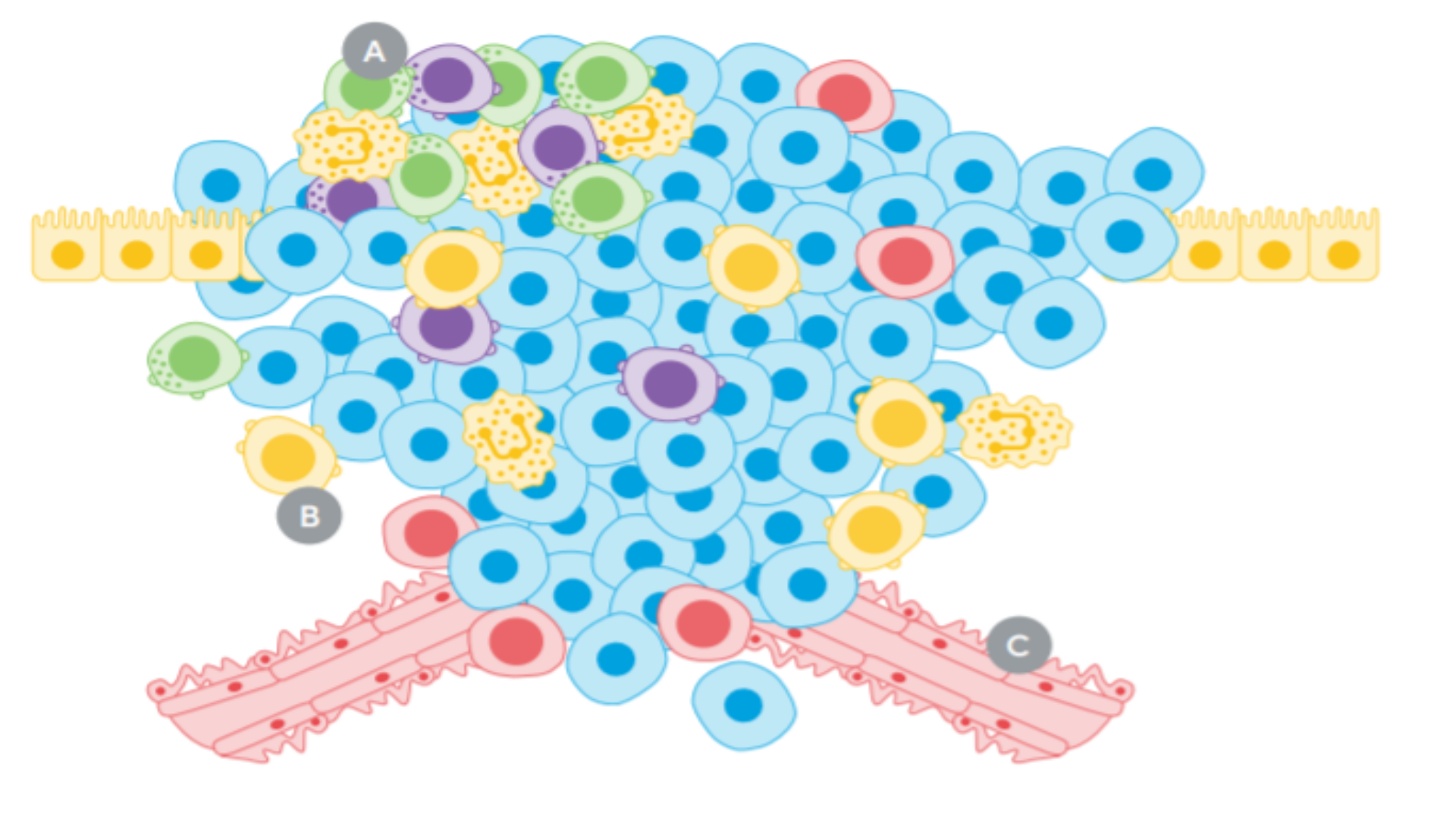 Resolve cancer with single cell and spatial multiomics. Our ...