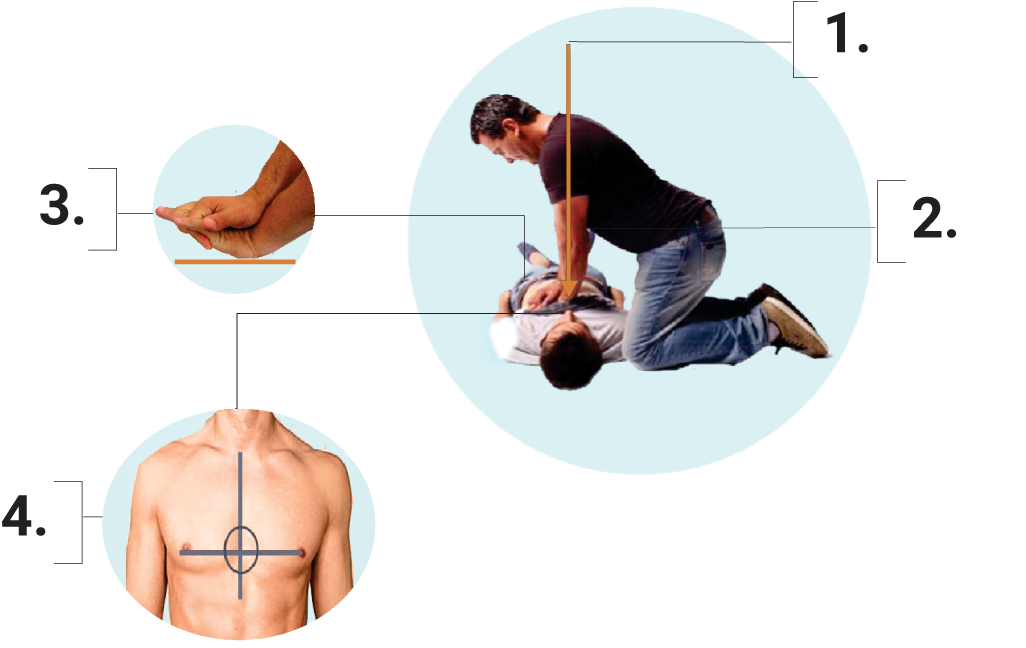 REANIMACION CARDIO PULMONAR (RCP) ¿Qué ES? ~ Mujer Mexicana