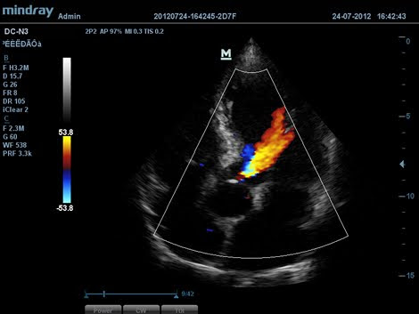 USG 4 Dimensi DC-N3 PRO Mindray, USG 4D Terbaik dan Tercanggih ...