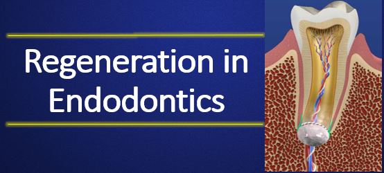 Regeneration in Endodontics- Current Status in Endodontics