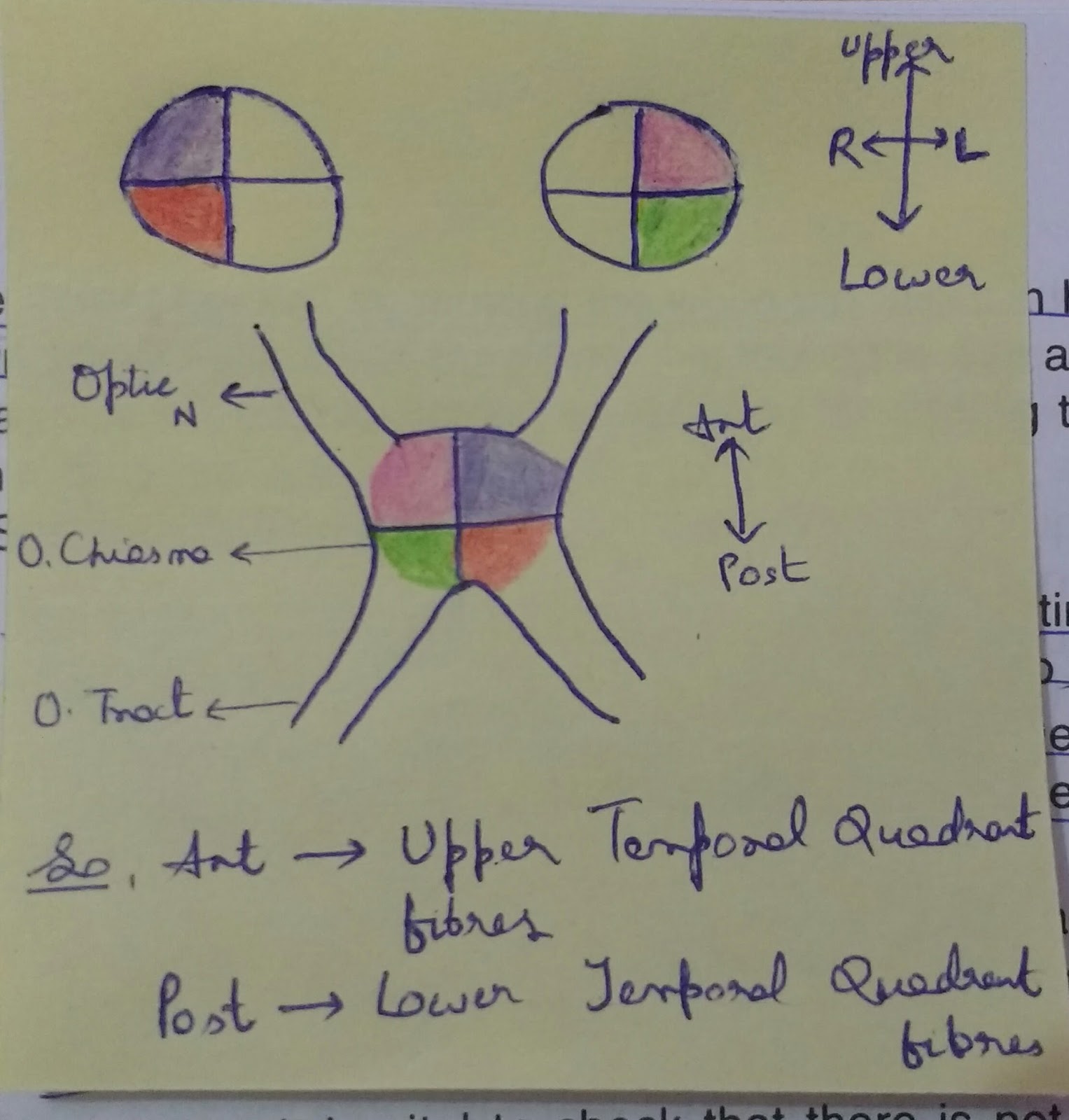 Medicowesome: Differentials of Unilateral Central Scotoma