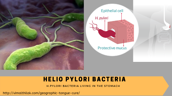 BURNING TONGUE TREATMENT |GEOGRAPHIC TONGUE CURE | 100% GUARANTEED ...