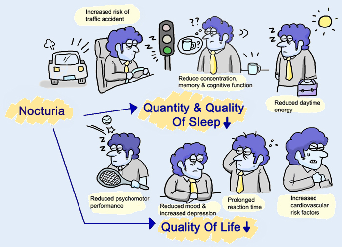 Madrid Urología: Nicturia y Poliuria Nocturna. MU