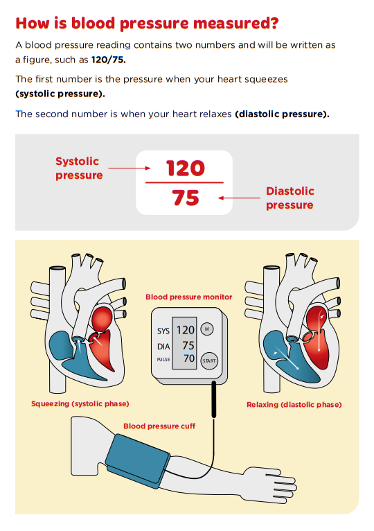 High Blood Pressure (Hypertension) | Medical Notes