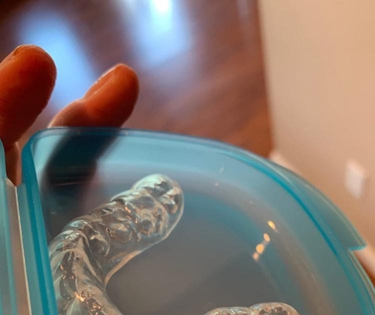 How to Clean Retainers: A Step-by-Step Guide