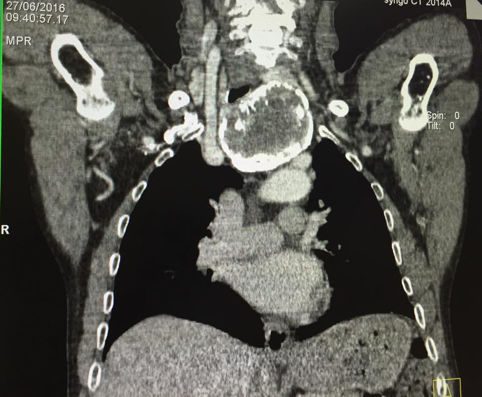 EL RINCÓN DE LA MEDICINA INTERNA. juanpedromacaluso@yahoo.com.ar ...