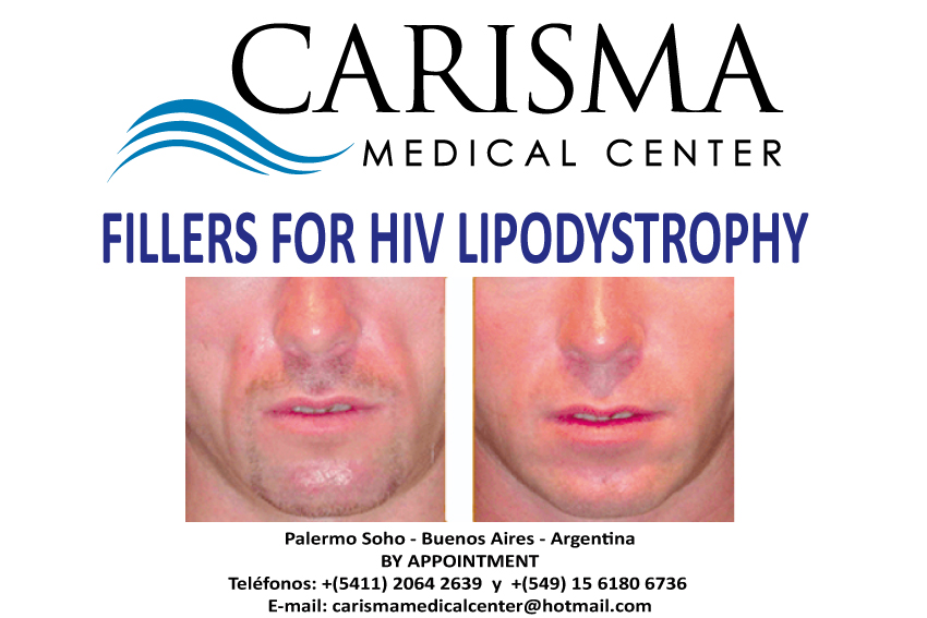 Centro Dermatológico Dr. Ramírez Medina - Sección Hombres: TREATMENT OF ...