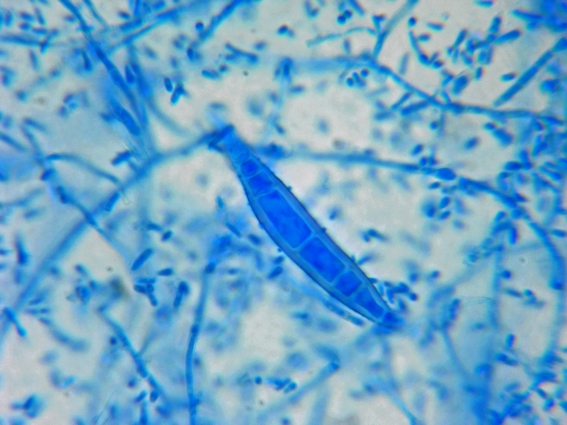 Fun With Microbiology (What's Buggin' You?): Microsporum audouinii