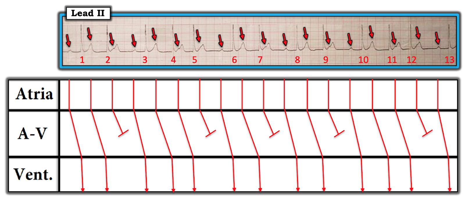 ECG Interpretation: May 2019