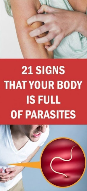 Here 21 Signs Parasites Are Living In Your Body!