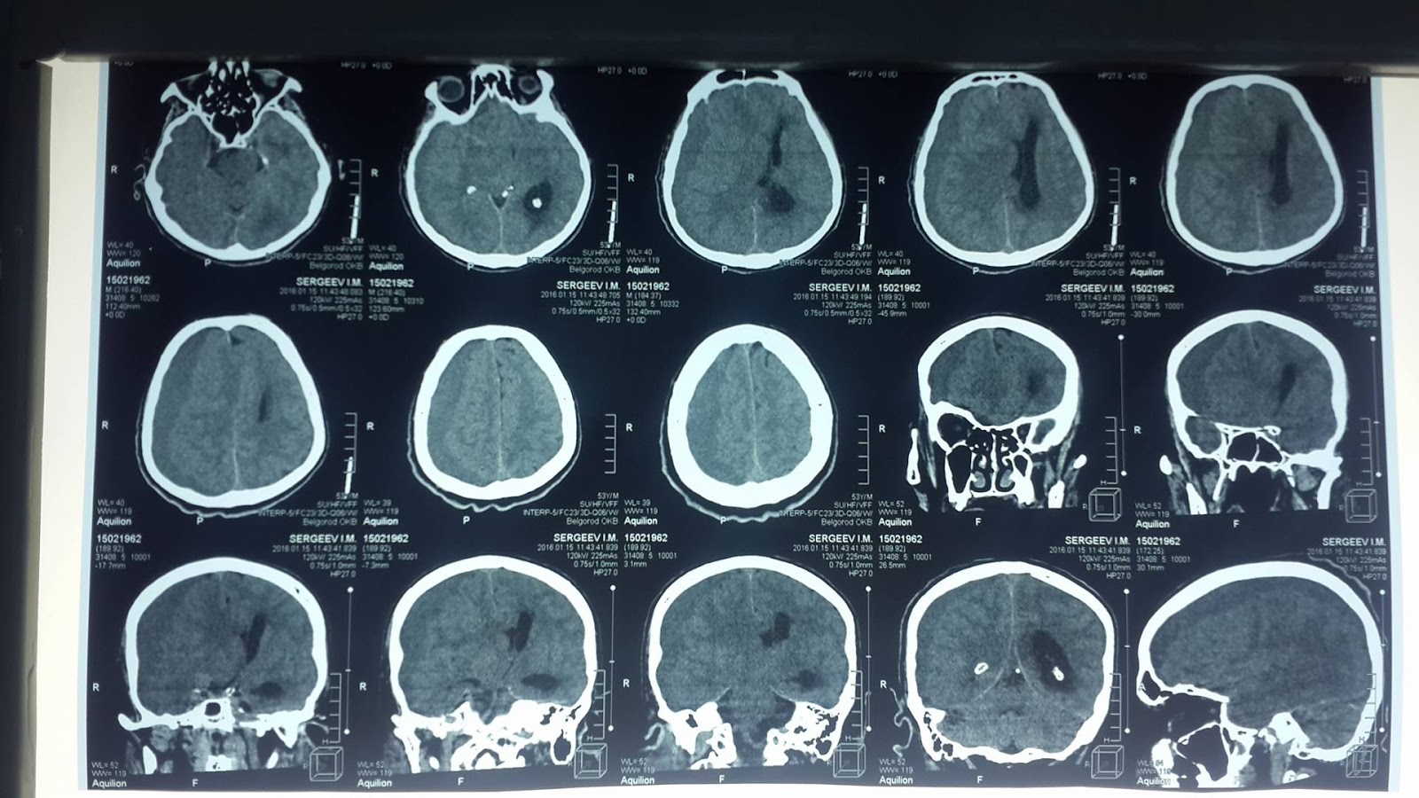 EL RINCÓN DE LA MEDICINA INTERNA. juanpedromacaluso@yahoo.com.ar ...