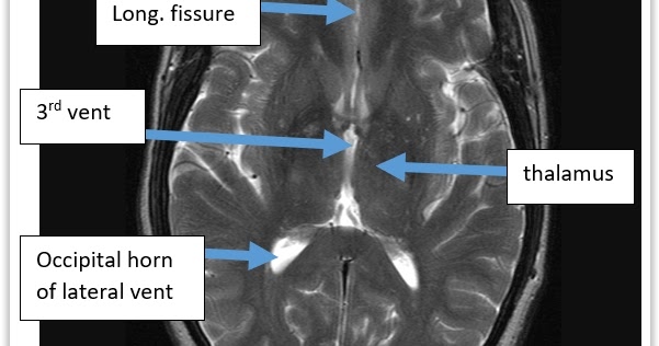 Michael's MRI Study Page: PROCEDURES I (MRI 104)