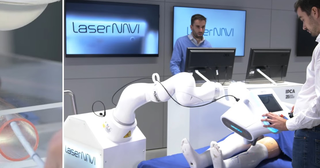 Finalists of the KUKA Medical Robotics Innovation Award 2019