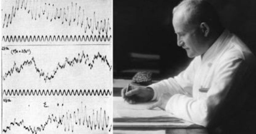 History: EEG