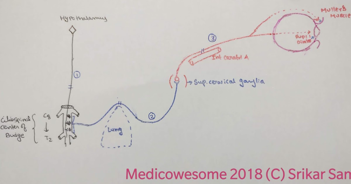 Medicowesome: Horner Syndrome