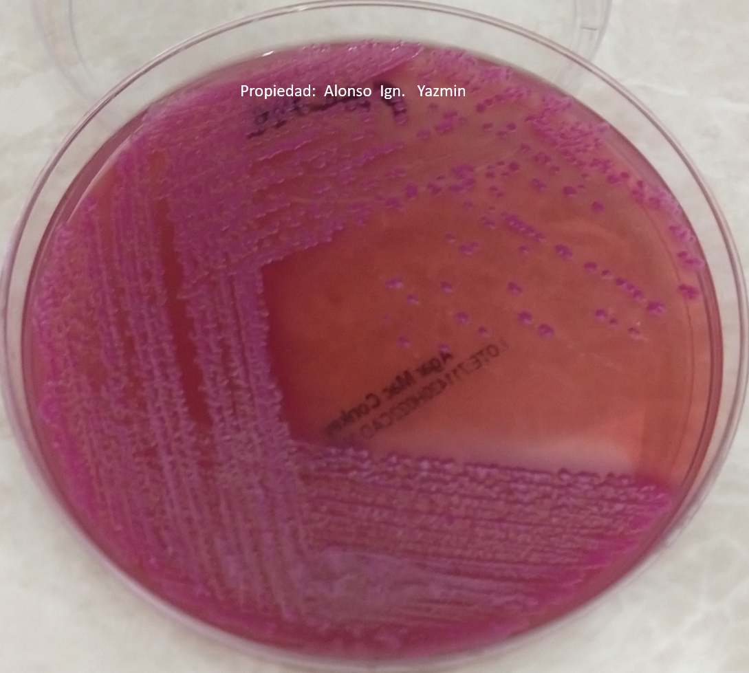 Bioquímica Diagnóstica BQD-YAI: Escherichia coli