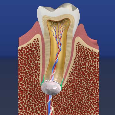 Regenerative Endodontics: Saving Teeth with Stem Cells