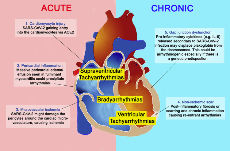 PHARMACO PLUS: Heart Infections