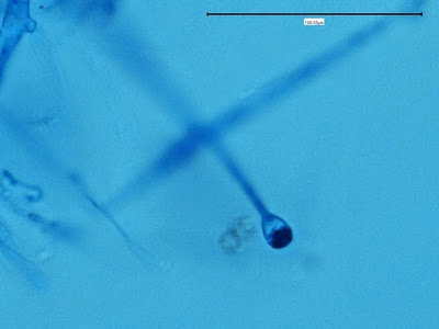 Fun With Microbiology (What's Buggin' You?): Apophysomyces elegans ...