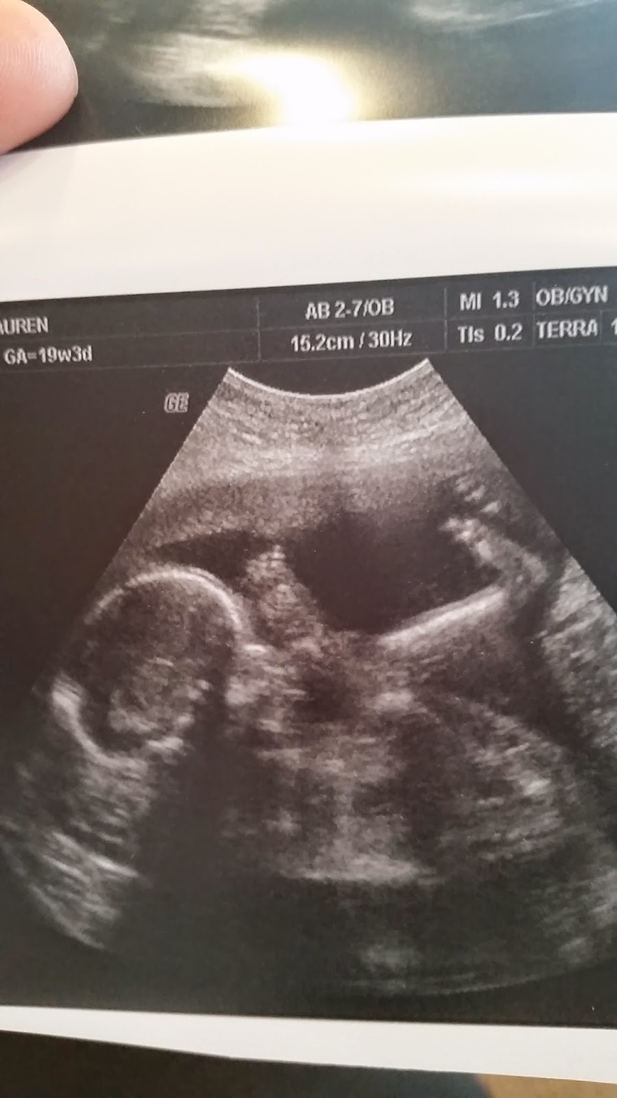 Baby Collier: 19 Weeks and 3 Days: Anatomy Scan!