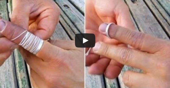 Insta Trends: How to Remove a Ring That Won’t Come Out
