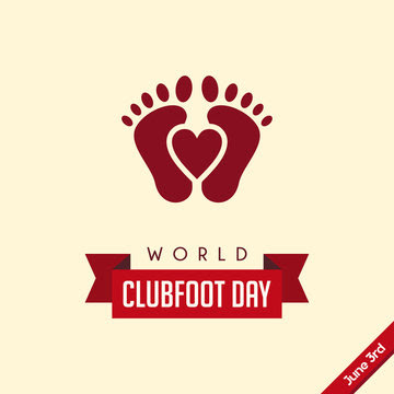 World Clubfoot Day - 03 June. ~ CURRENT AFFAIRS (CA) DAILY UPDATES