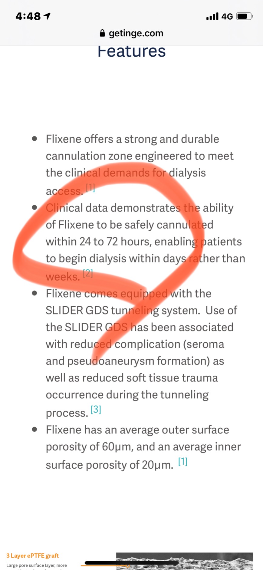 張智鴻醫師 腎臟科 洗腎 血液透析 新鴻遠診所: Flixene Vascular Grafts 提供腎臟病患急需透析(洗腎)通路另一個選擇