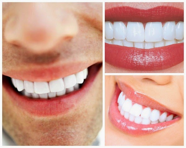 When White Teeth Are Just WAY Too White [ Being Ron ]