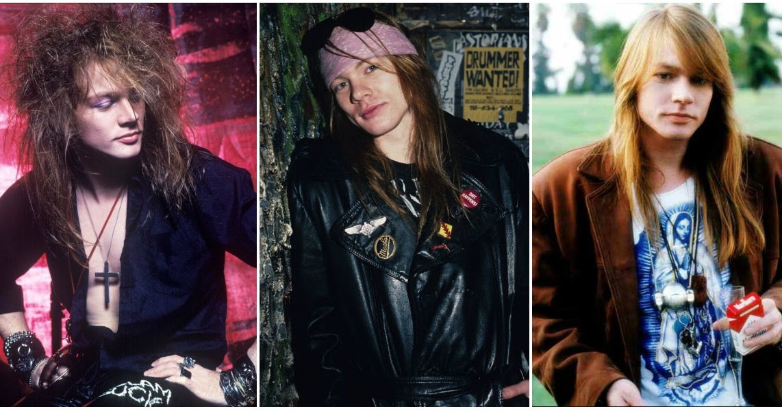 Axl Rose Before And After