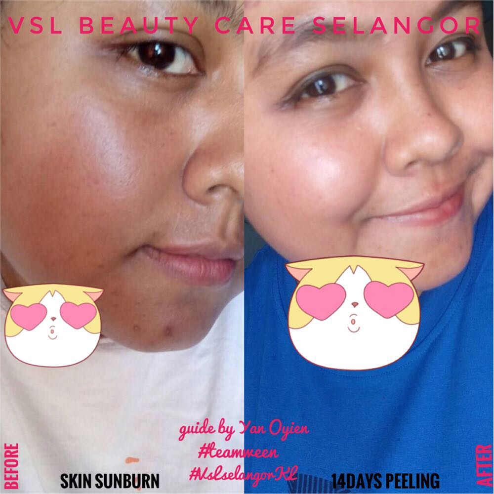 PRODUK PEMUTIH DAN PENGELUPASAN VSL BEAUTY CARE: PRODUK PEMUTIH DAN ...