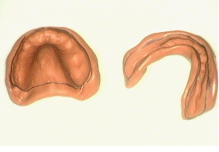 Dentistry and Medicine: Non Elastic Impression Materials-Prosthetic ...