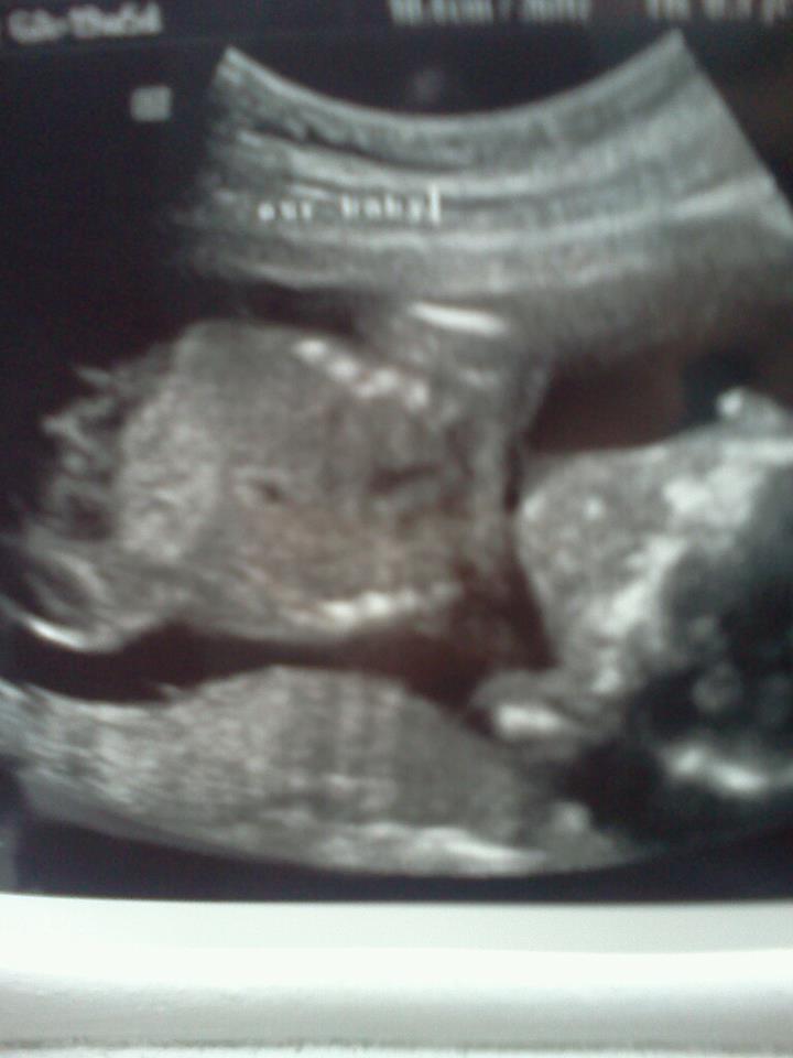 Our Journey With Baby: 21 Week Ultrasound