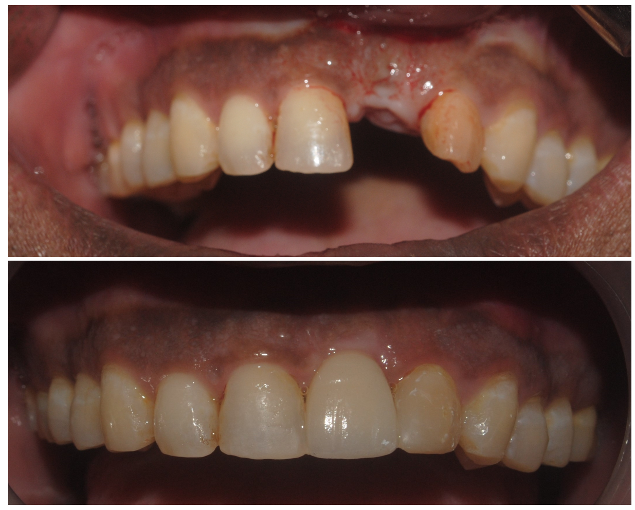 - THE DENTAL EXCELLENCE