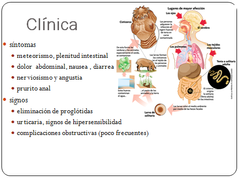 Parasitosis por Tenia Solium: Teniasis