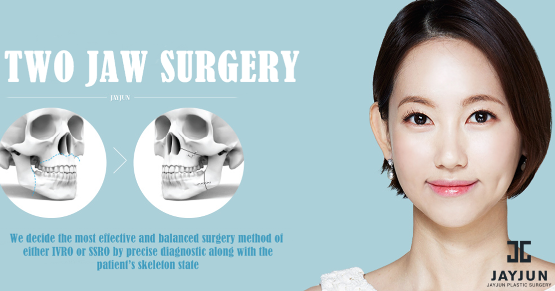 Jayjun Plastic Surgery Korea: Types of TWO JAW SURGERY : SSRO (Sagittal ...