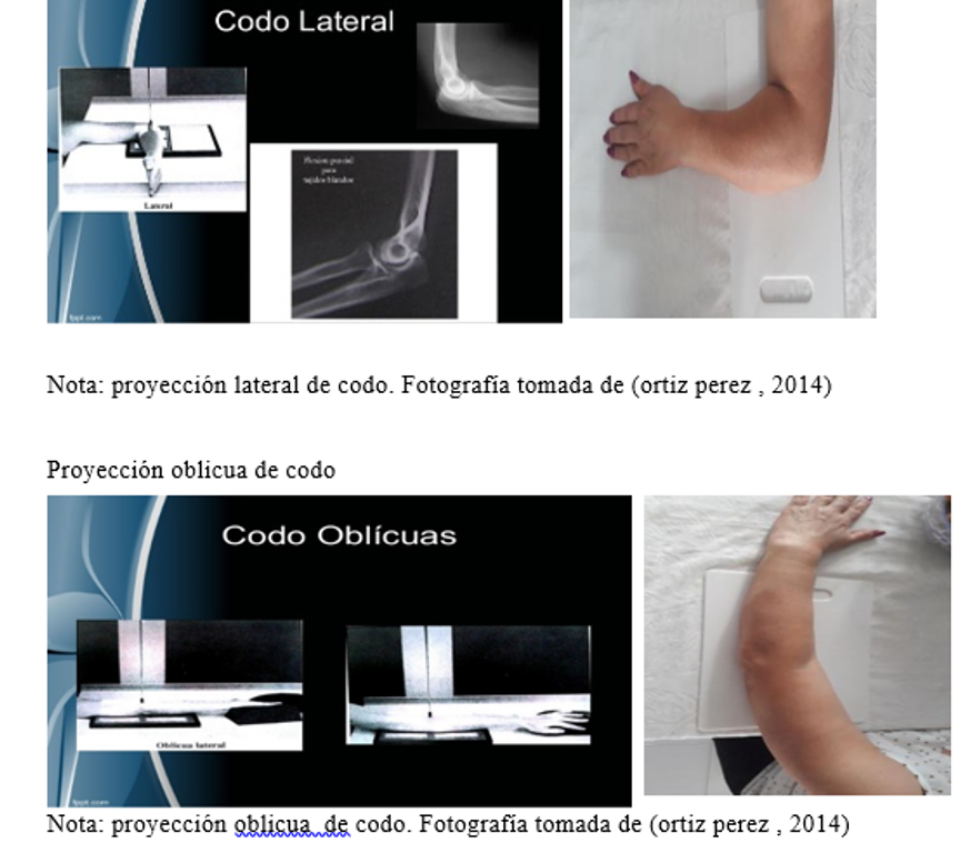 CONCEPTUALIZACION ANATOMICA : ESTUDIOS RADIOGRAFICOS DE MIEMBROS SUPERIORES