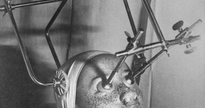 15 Unusual and Bizarre Beauty Devices From Between the 1920s and 1940s ...