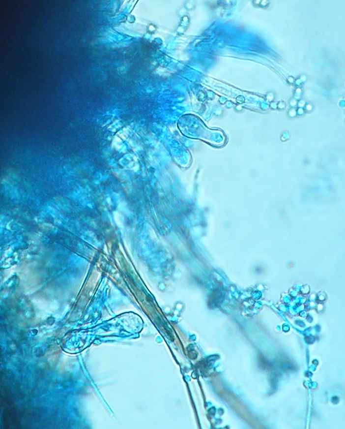 ATLAS MICOLOGIA: ASPERGILLUS USTUS COMPLEXO