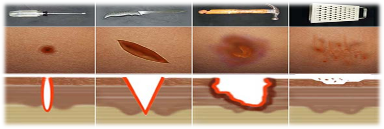 Prevenciona-T Health & Safety: GUÍA PRIMEROS AUXILIOS: HERIDAS Y ...