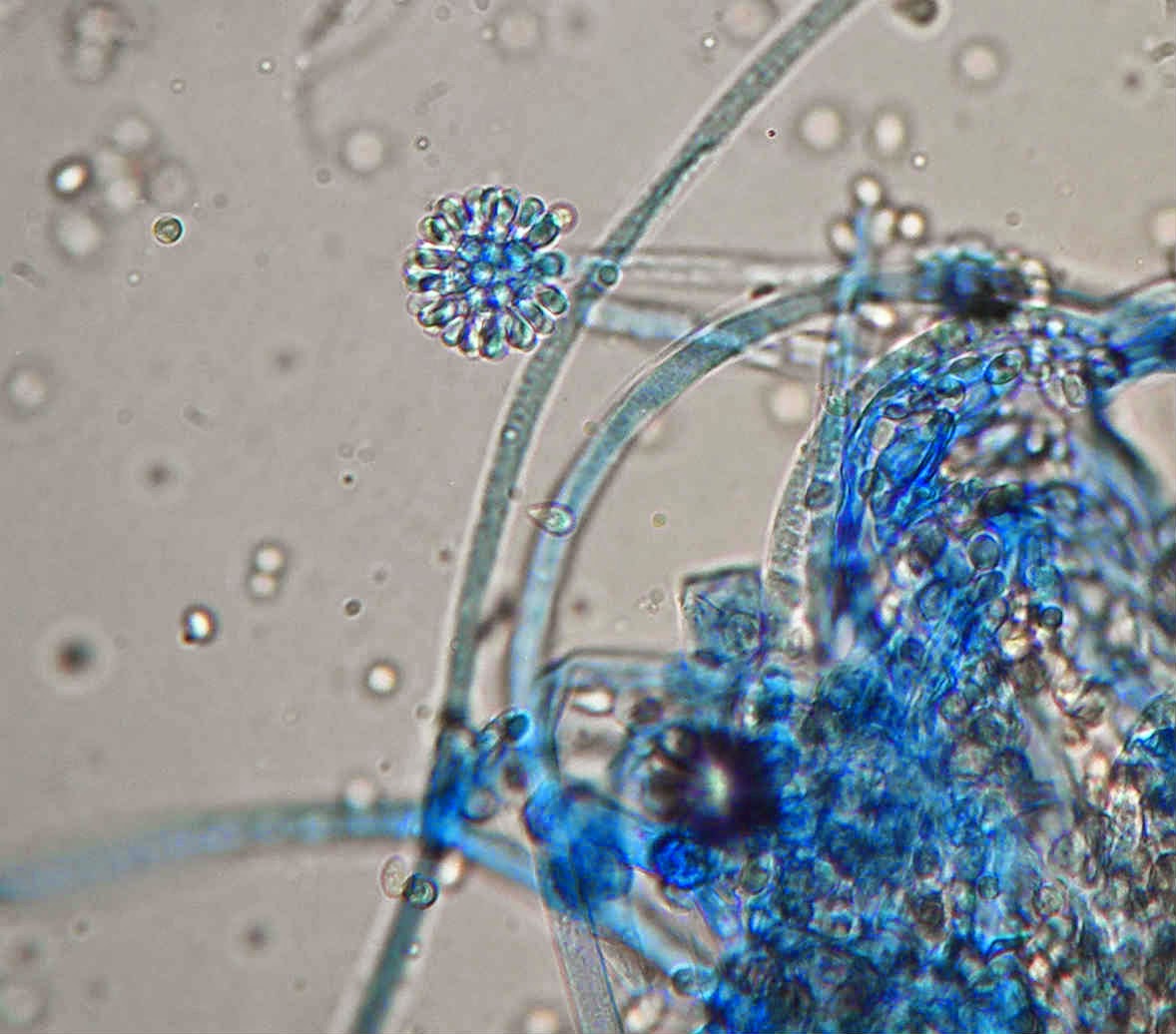 ATLAS MICOLOGIA: CUNNINGHAMELLA BERTHOLLETIAE