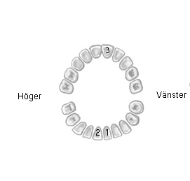 Mamma till Flugan och lillebror: Tand nummer tre