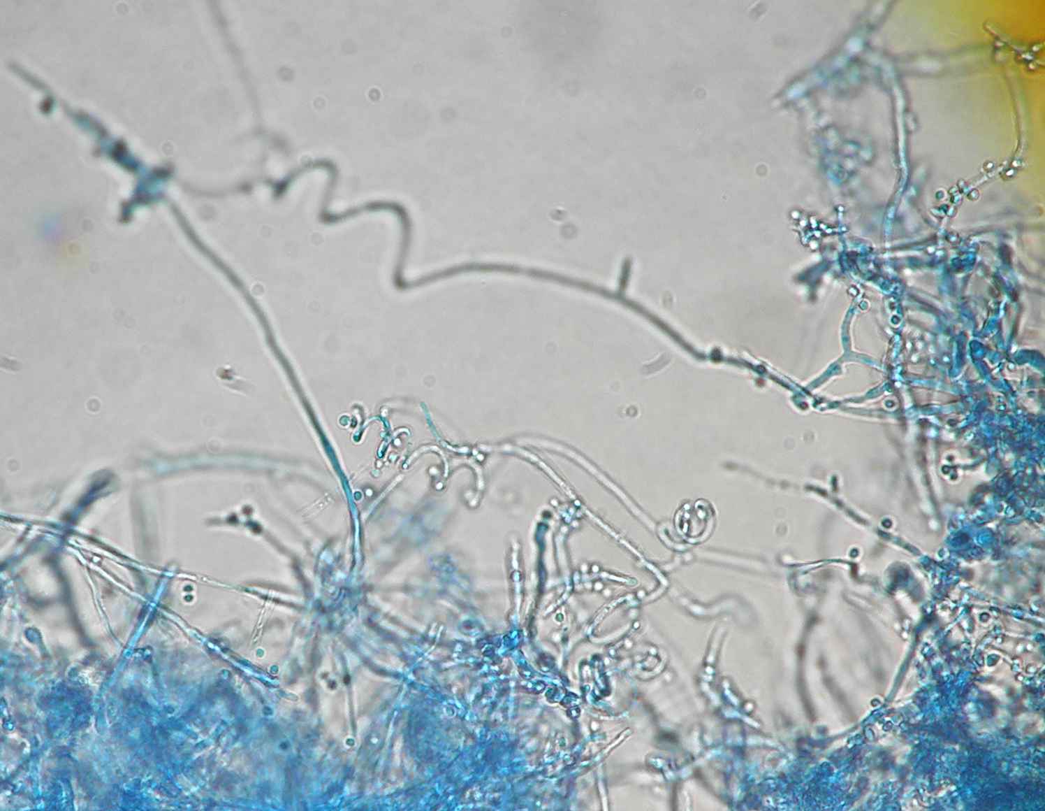ATLAS MICOLOGIA: TRICHOPHYTON INTERDIGITALE